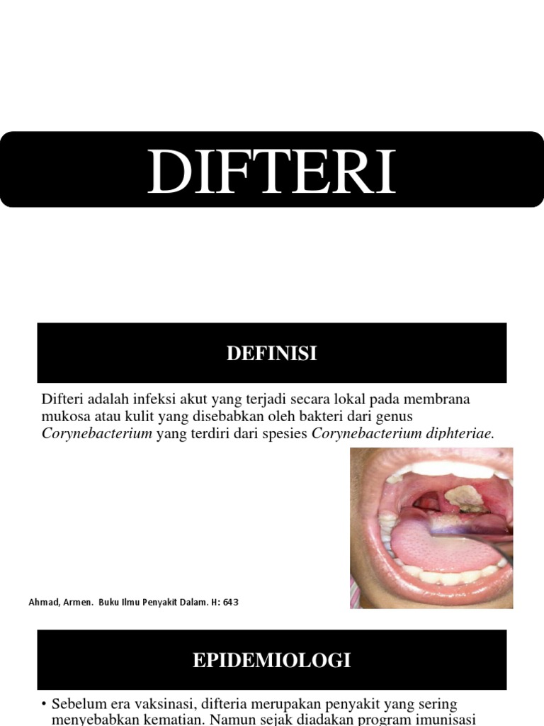 Difteri | PDF