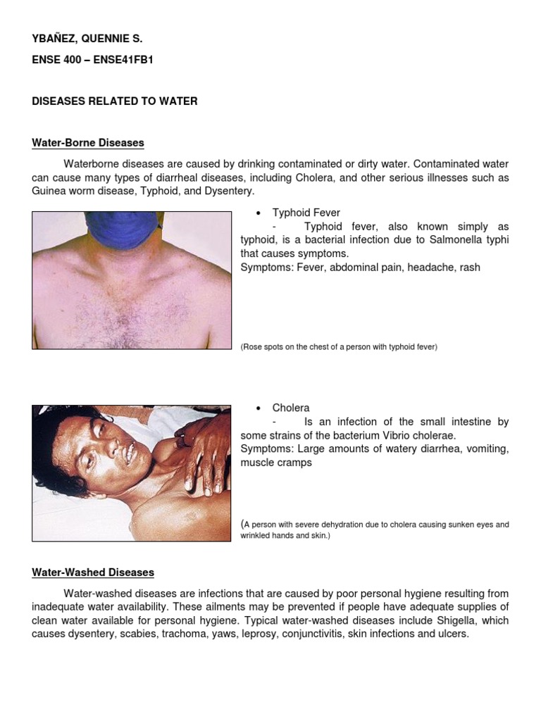 Salmonella Typhi Rose Spots
