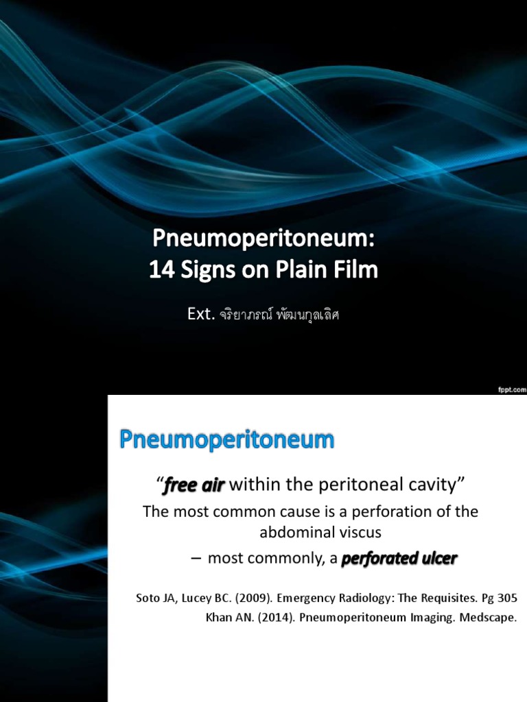 Pneumoperitoneum Signs PDF | PDF | Peritoneum | Abdomen