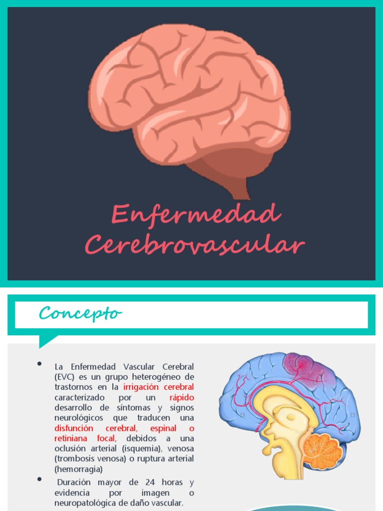 Enfermedad Cerebrovascular | PDF | Carrera | Isquemia