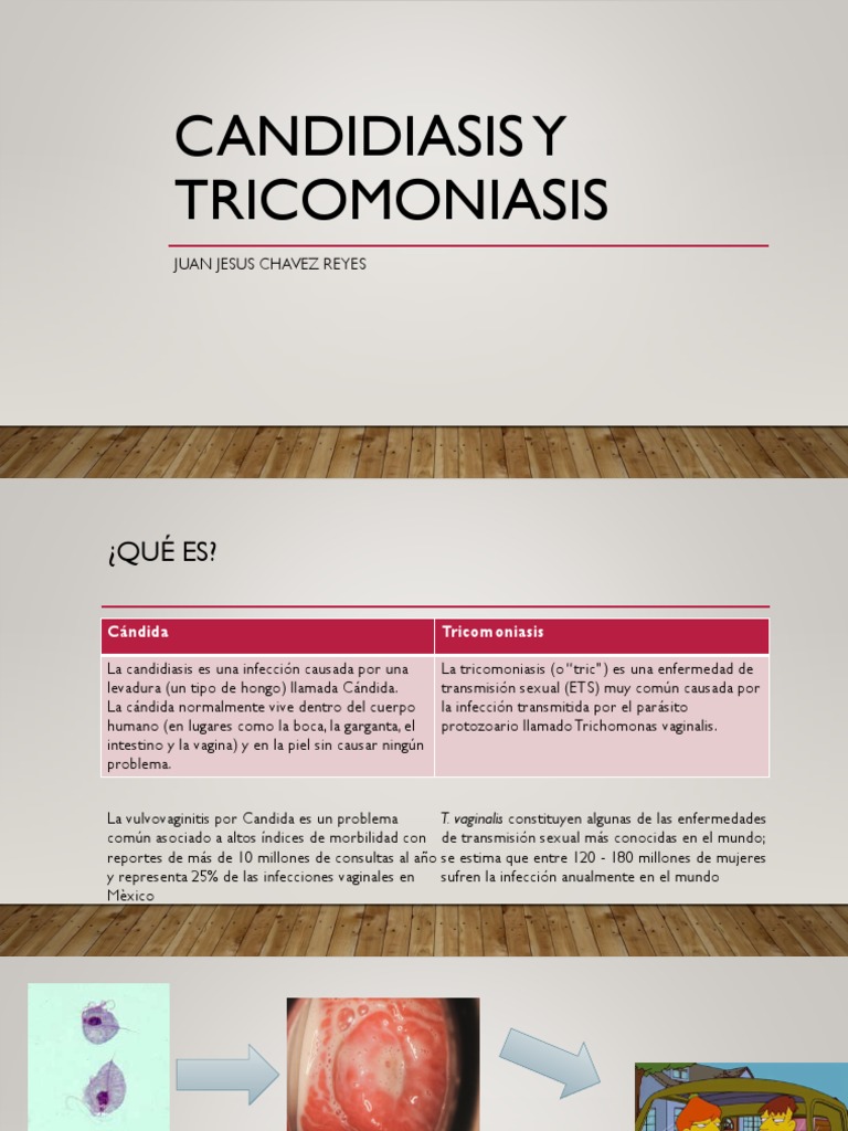 Candidiasis y Tricomoniasis | Descargar gratis PDF | Candidiasis ...