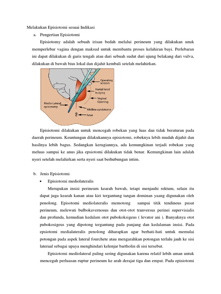 Melakukan Episiotomi Sesuai Indikasi | PDF