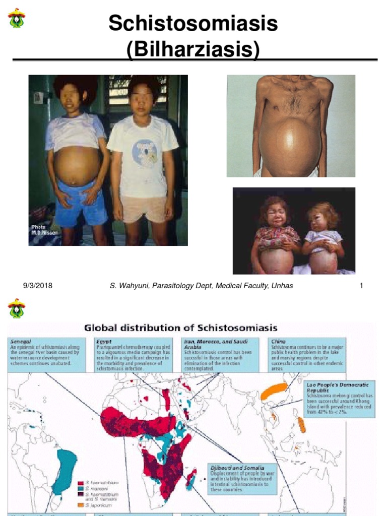 Schistosomiasis (Bilharziasis) : S. Wahyuni, Parasitology Dept, Medical ...