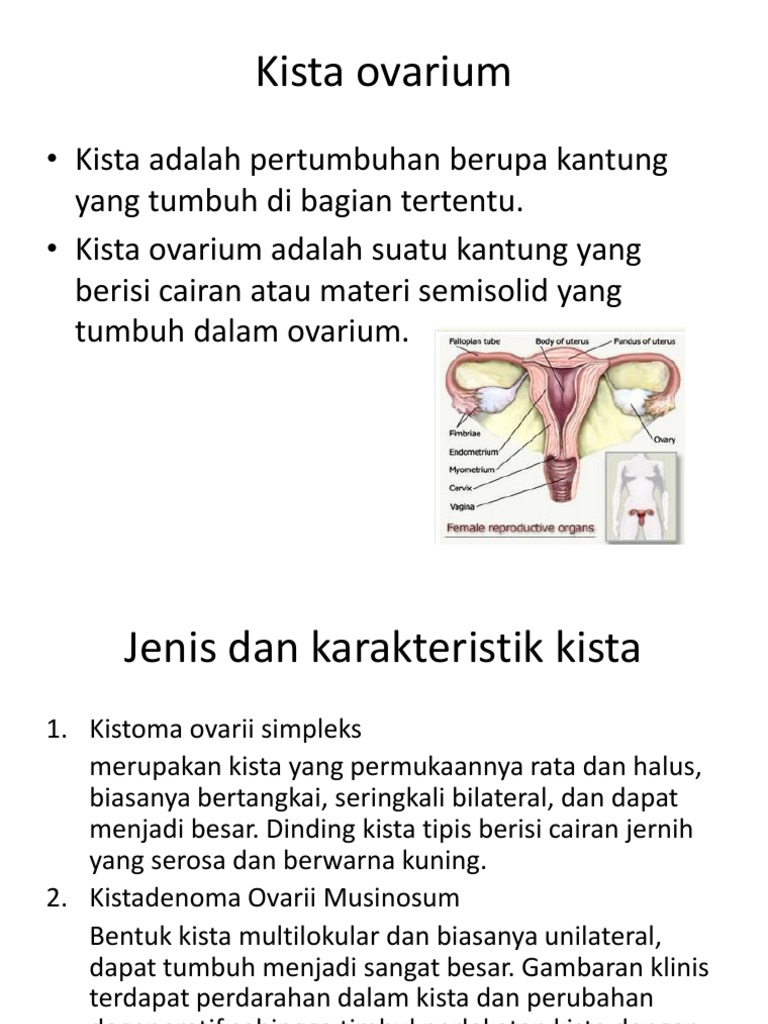 Kista Ovarium | PDF