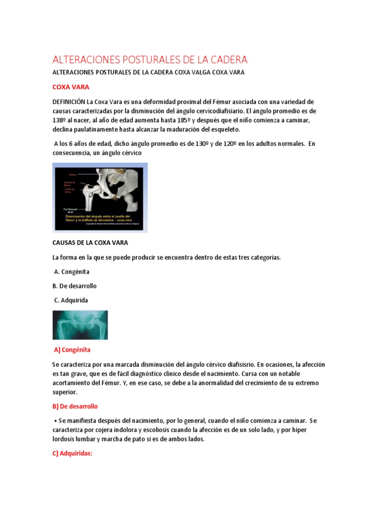 Alteraciones de cadera en niños: coxa valga y vara | PDF | Rodilla | Pie