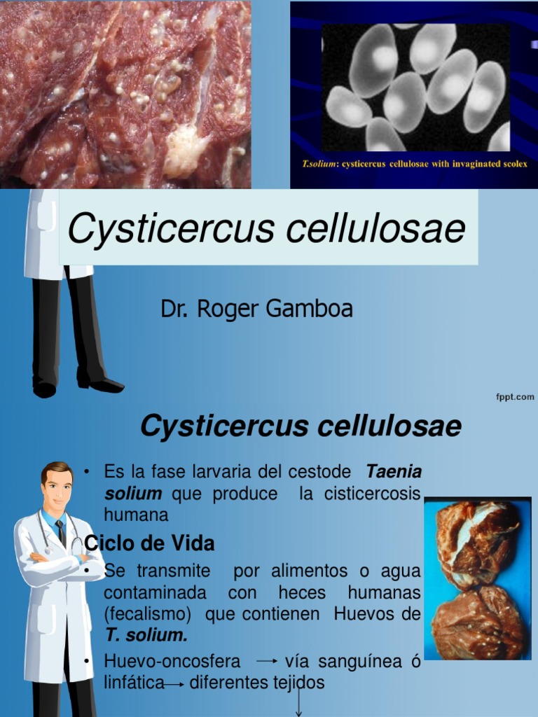Cysticercus cellulosae: Características, ciclo de vida, patogenia ...