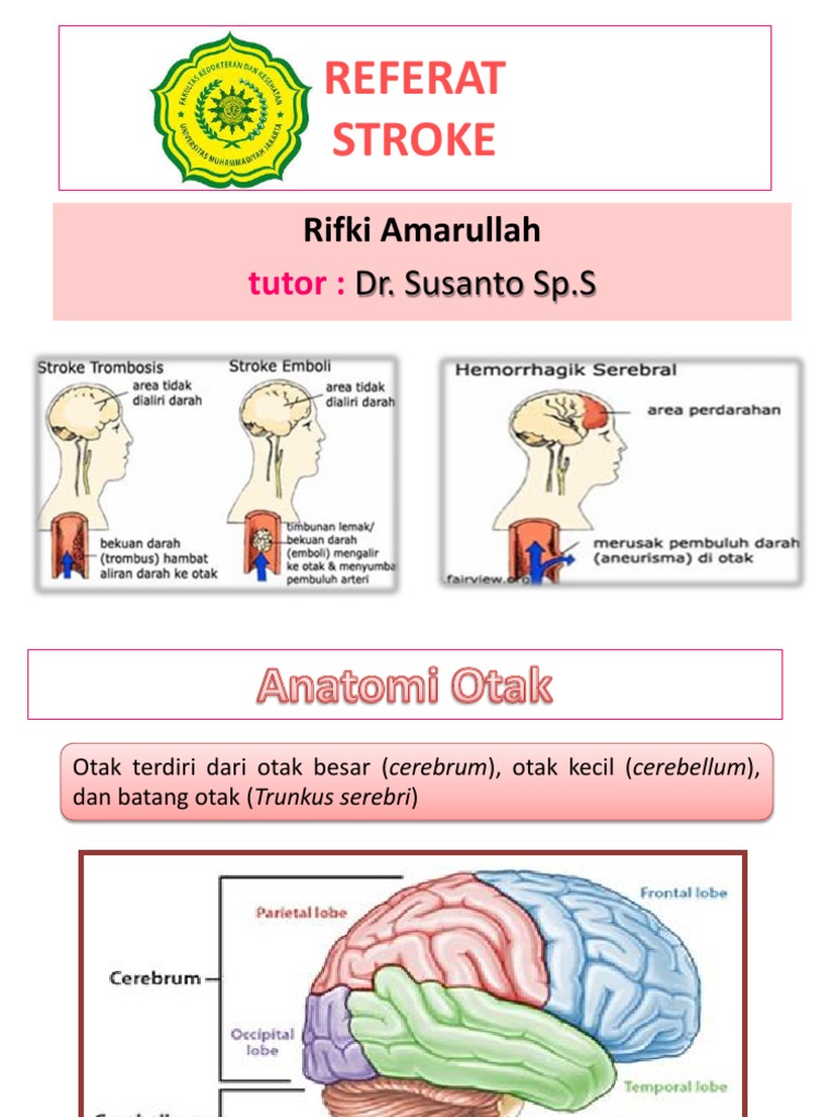 Stroke Iskemik | PDF