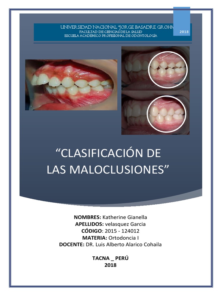 Informe 4 Clasificación de Las Maloclusiones | Ortodoncia | Odontología ...