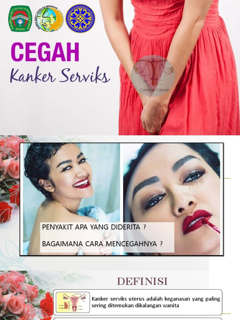 Penyuluhan Ca Cerviks | PDF