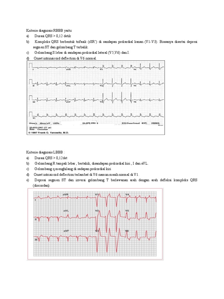 Kriteria Diagnosis RBBB - LBBB | PDF