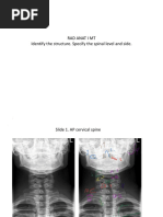 Open and Closed Packed Positions of Joints | PDF | Anatomical Terms Of ...