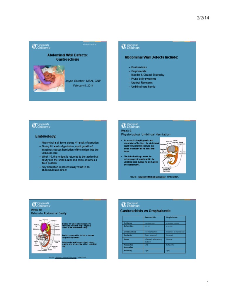 Abdominal Wall Defect | PDF | Clinical Medicine | Medical Specialties