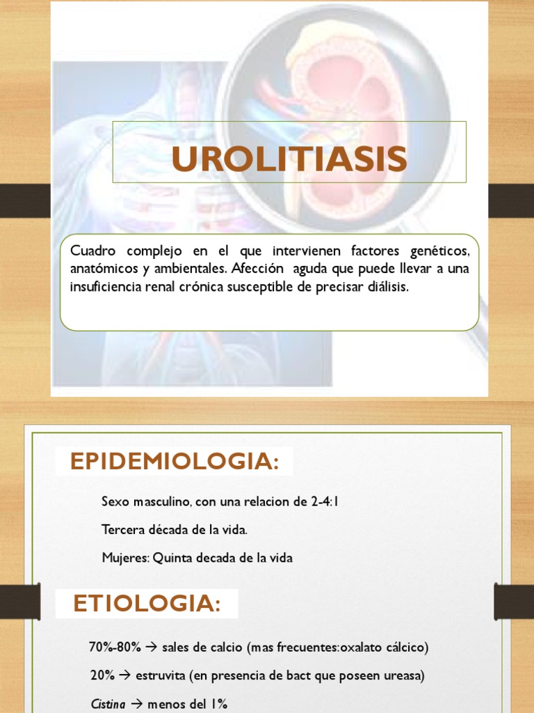 Guía Completa sobre Urolitiasis | PDF | Enfermedades y trastornos ...