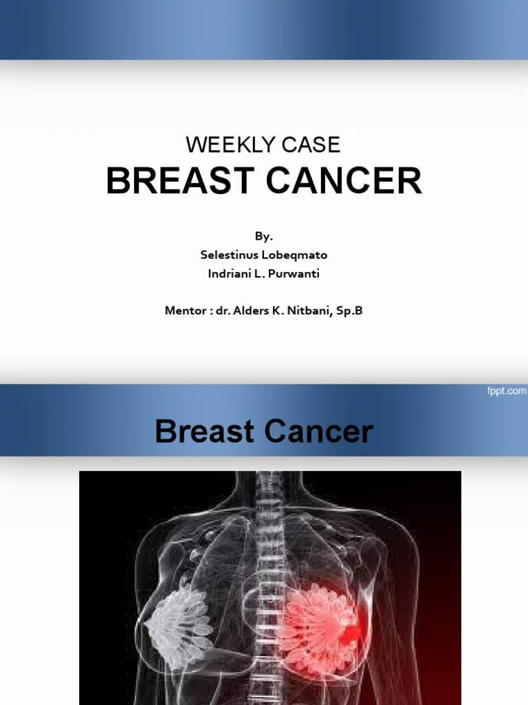 Breast Cancer: Weekly Case | PDF | Breast Cancer | Cancer