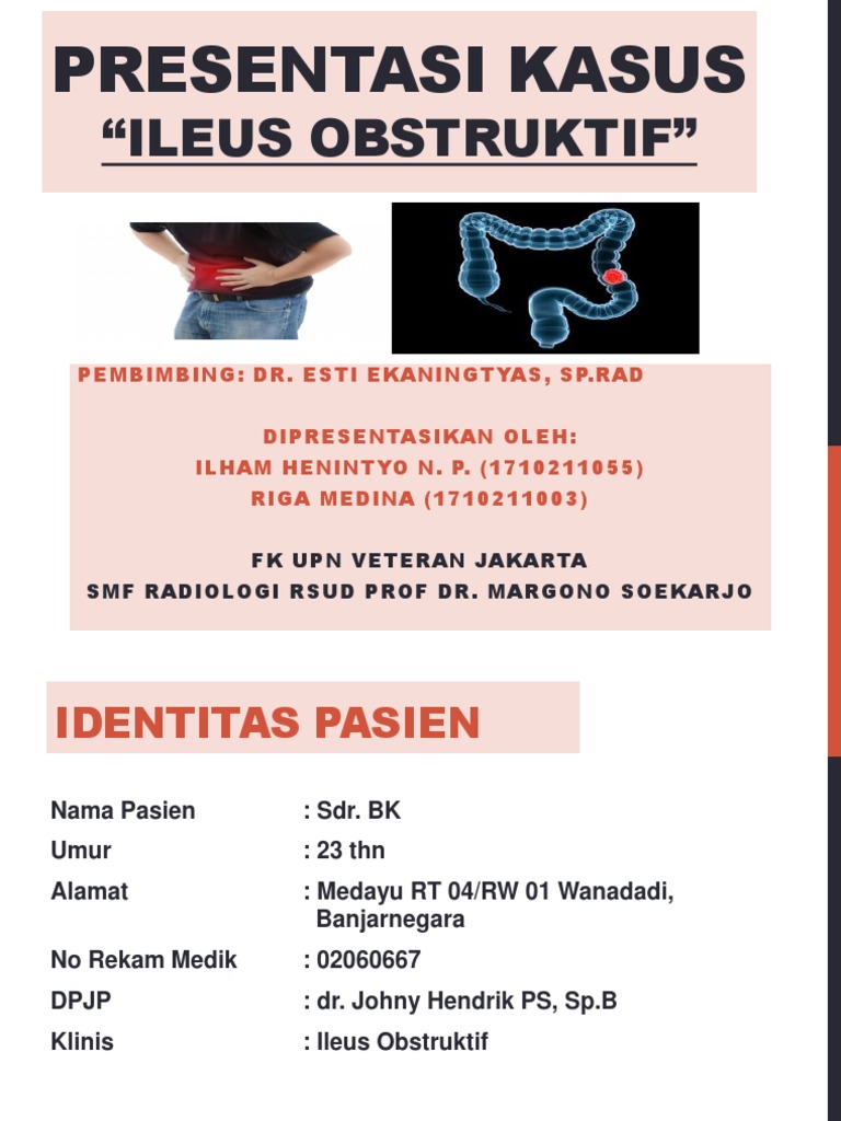 Ileus Obstruktif | PDF