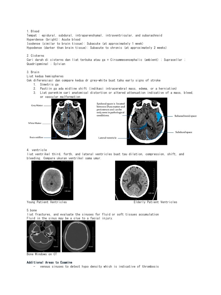 CT Scan Brain | PDF | Neurotrauma | Nervous System