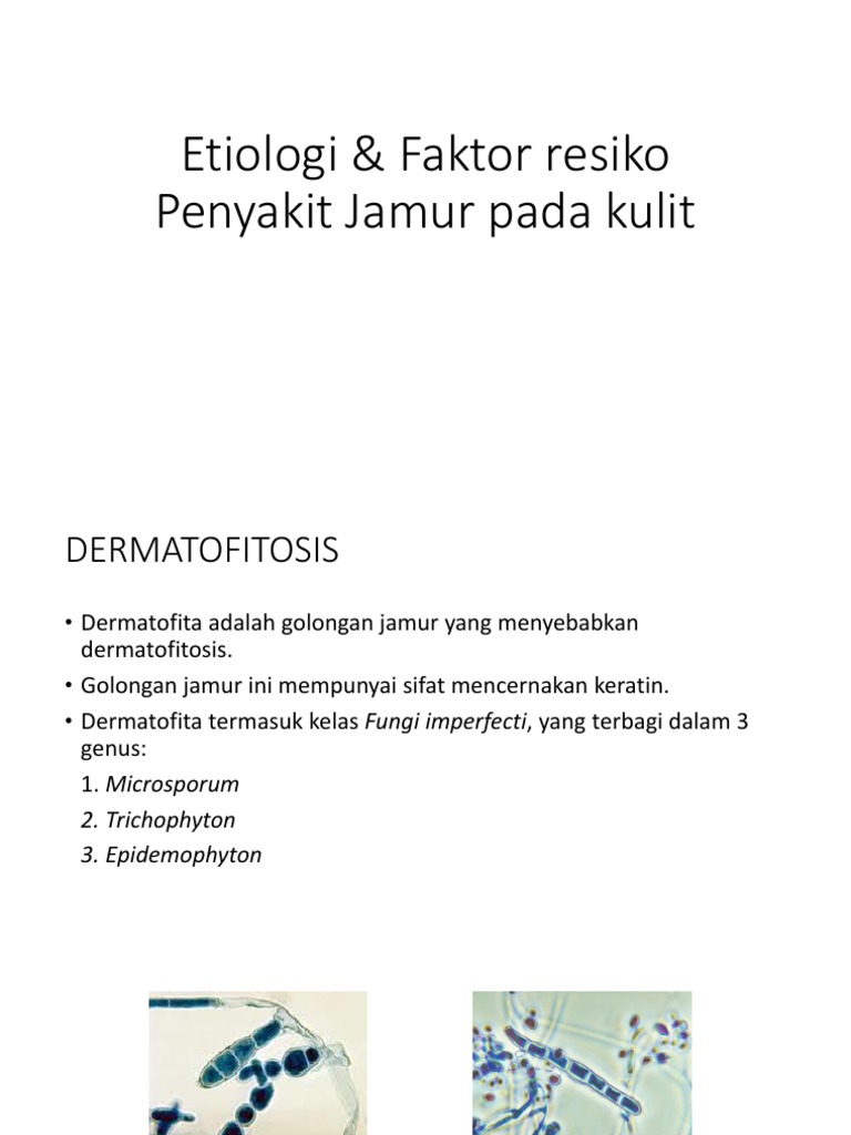 Etiologi & Faktor Resiko Infeksi Jamur Pada Kulit | PDF