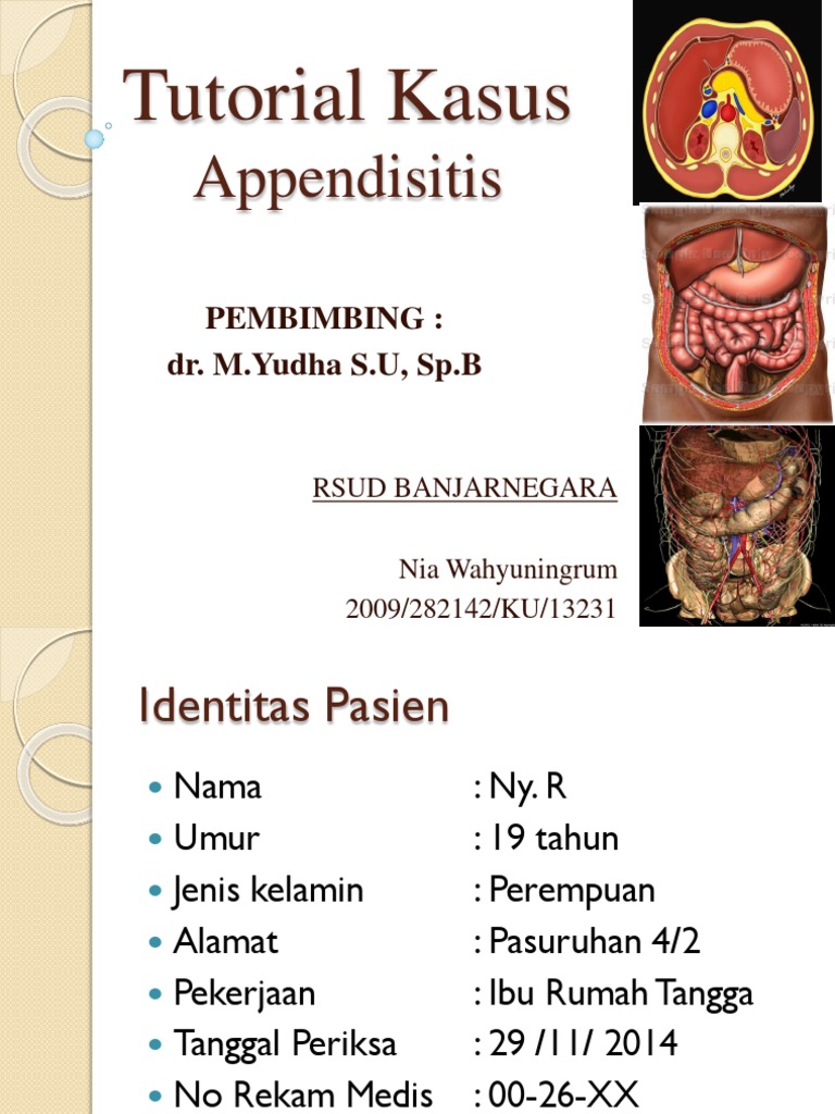 Acute Appendicitis Case Study | PDF