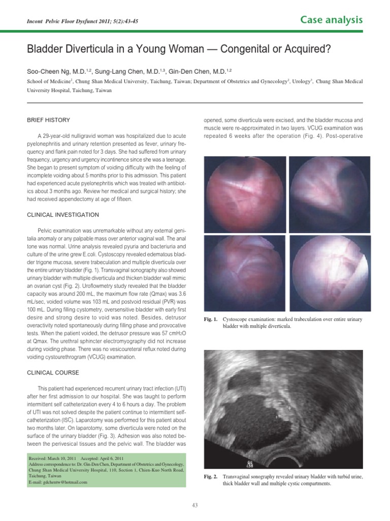 Bladder Diverticula in A Young Woman - Congenital or Acquired? | PDF | Urology | Urinary Bladder