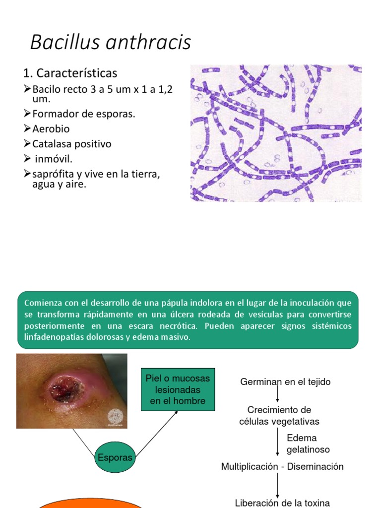 Bacillus anthracis: Características y Prevención | PDF | Ántrax ...