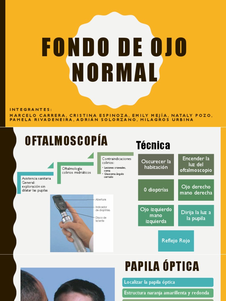 Fundoscopia y Evaluación del Ojo Normal | PDF | Ojo humano | Ojo