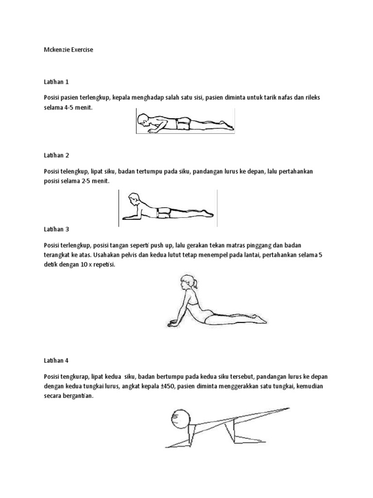 Mckenzie Exerci | PDF