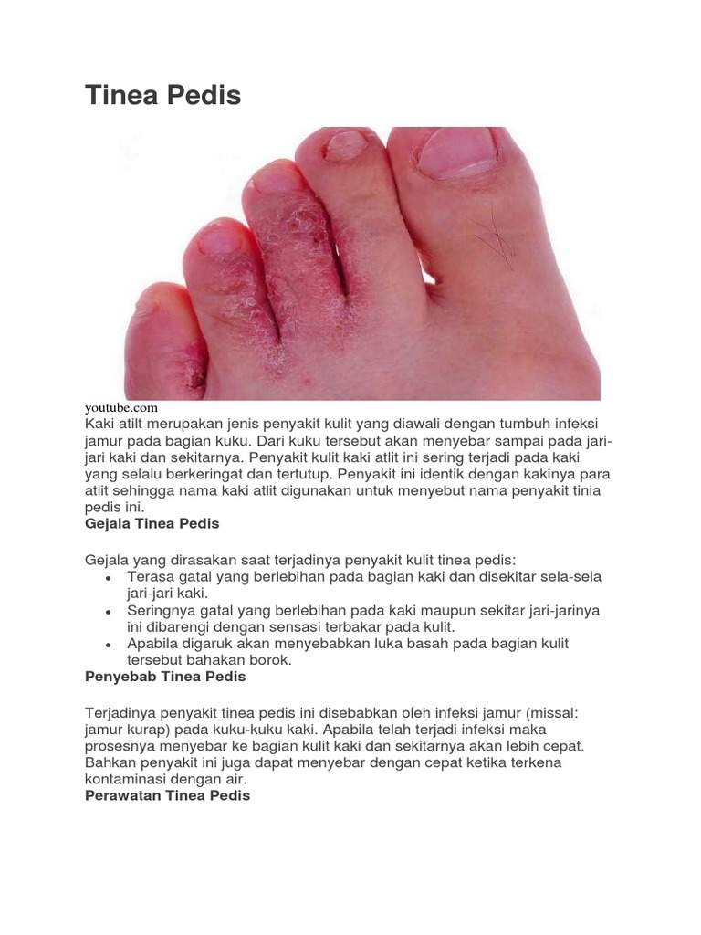Tinea Pedis | PDF