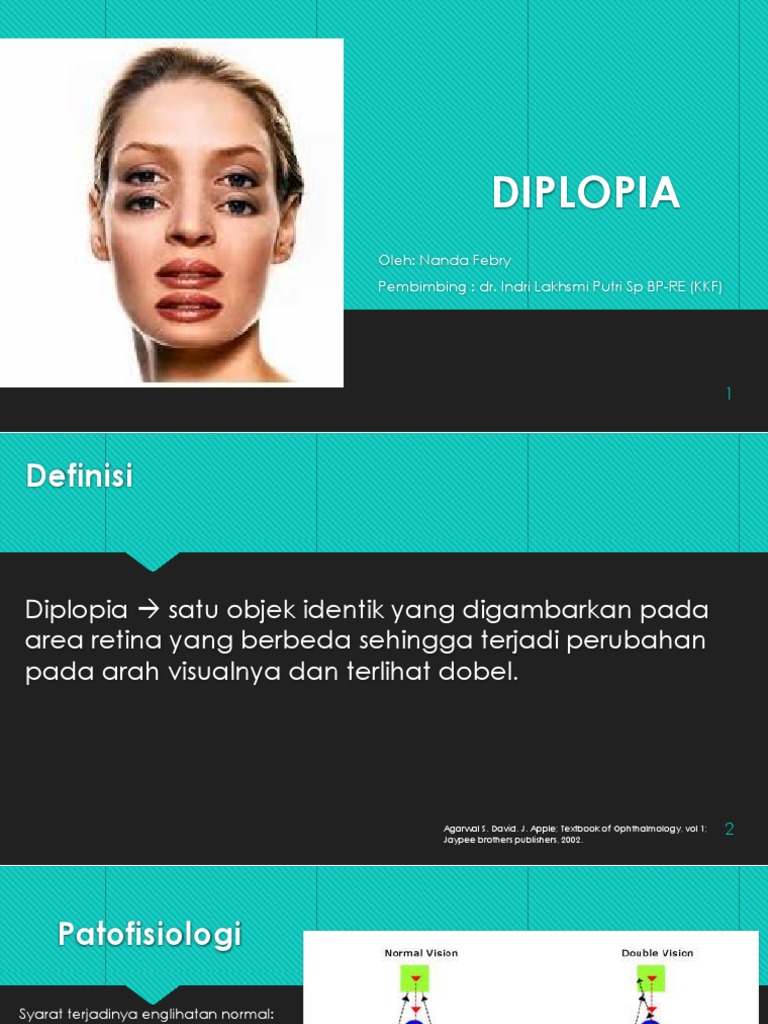DIPLOPIA | PDF