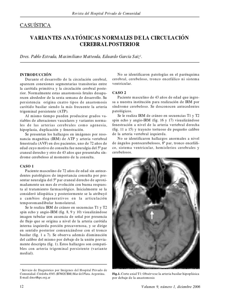Variantes Anatomicas Circulacion Cerebral | PDF | Angiología | Anatomía ...