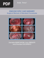 Step-by-Step FESS Surgical Guide | PDF | Human Nose | Human Head And Neck