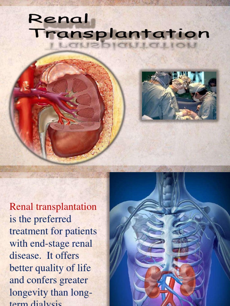 Renal Transplant | PDF | Kidney Transplantation | Organ Donation