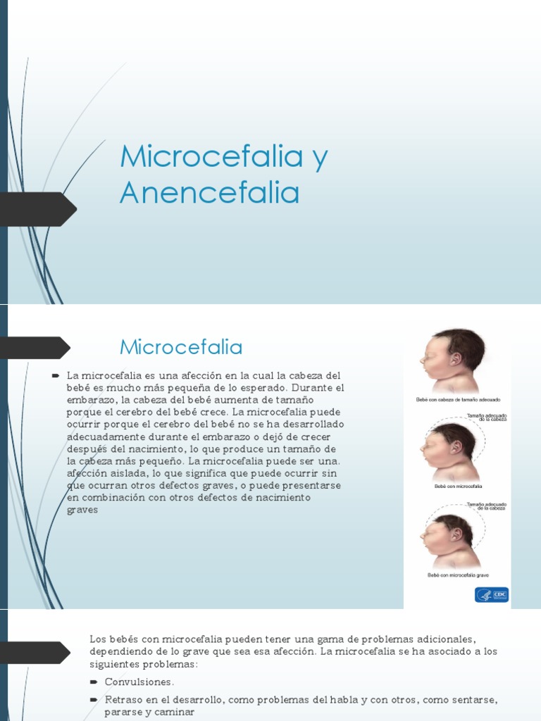 Microcefalia y Anencefalia | Sistema nervioso | Especialidades médicas