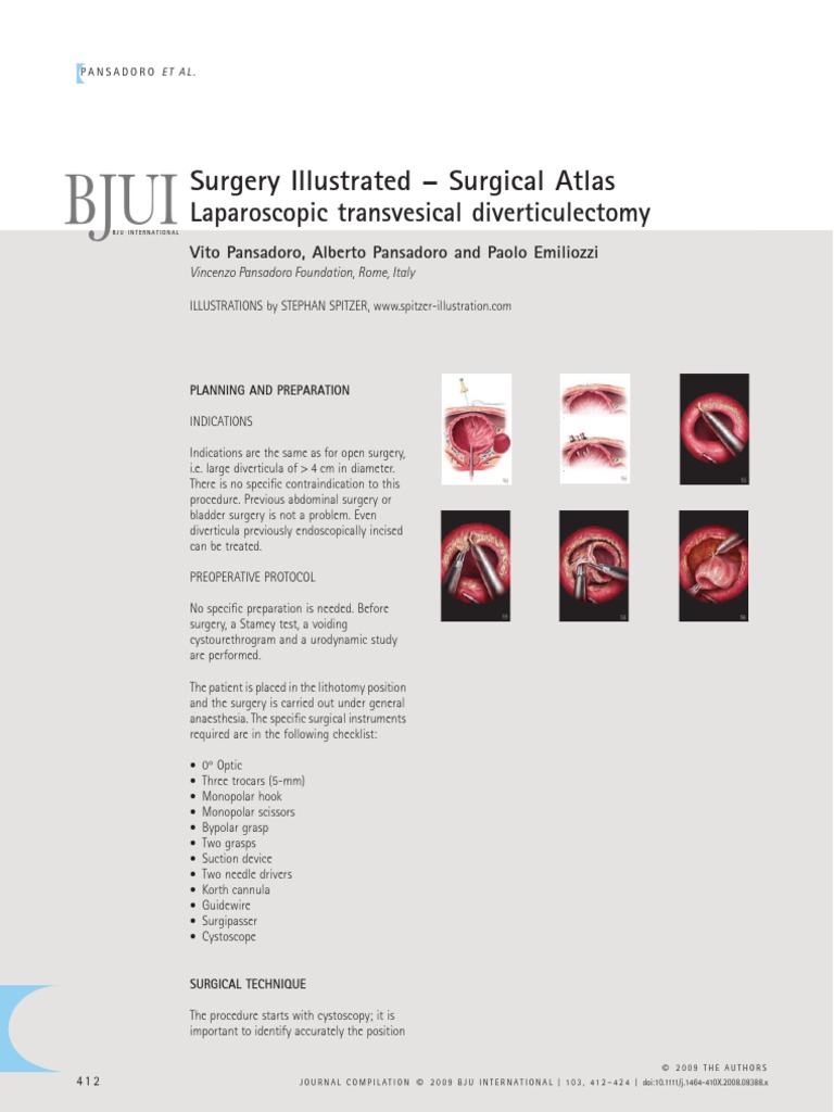 Surgery Illustrated - Surgical Atlas: Laparoscopic Transvesical ...