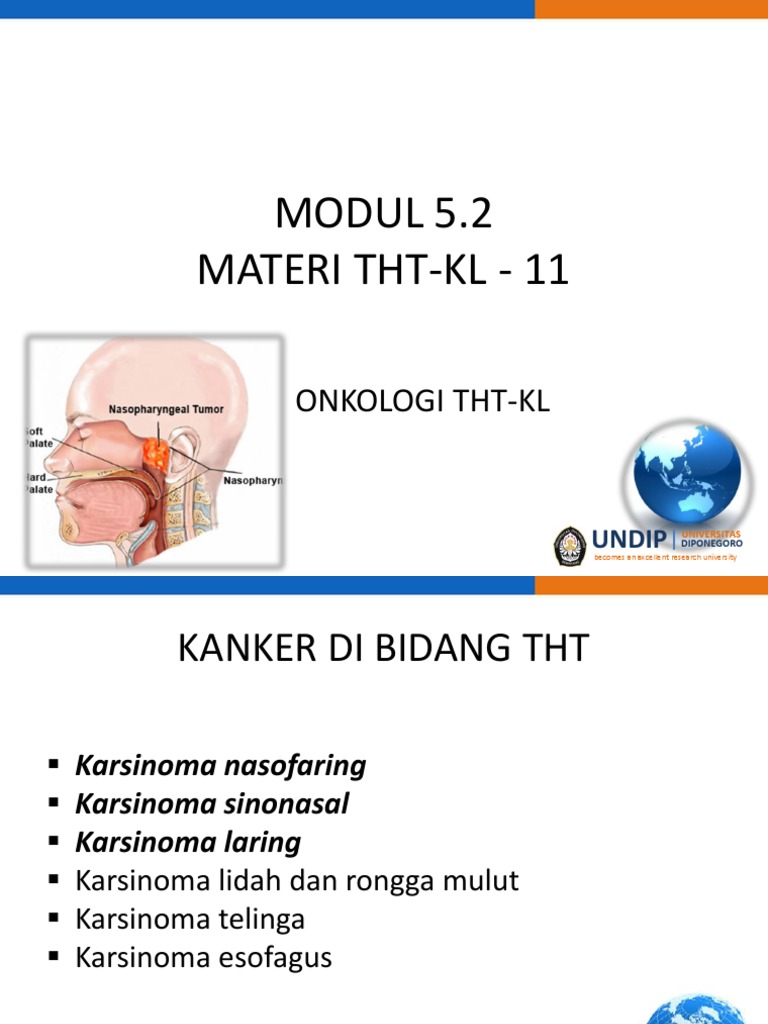 Karsinoma Laring: Gejala Klinis dan Stadium Berdasarkan Lokasi Tumor | PDF