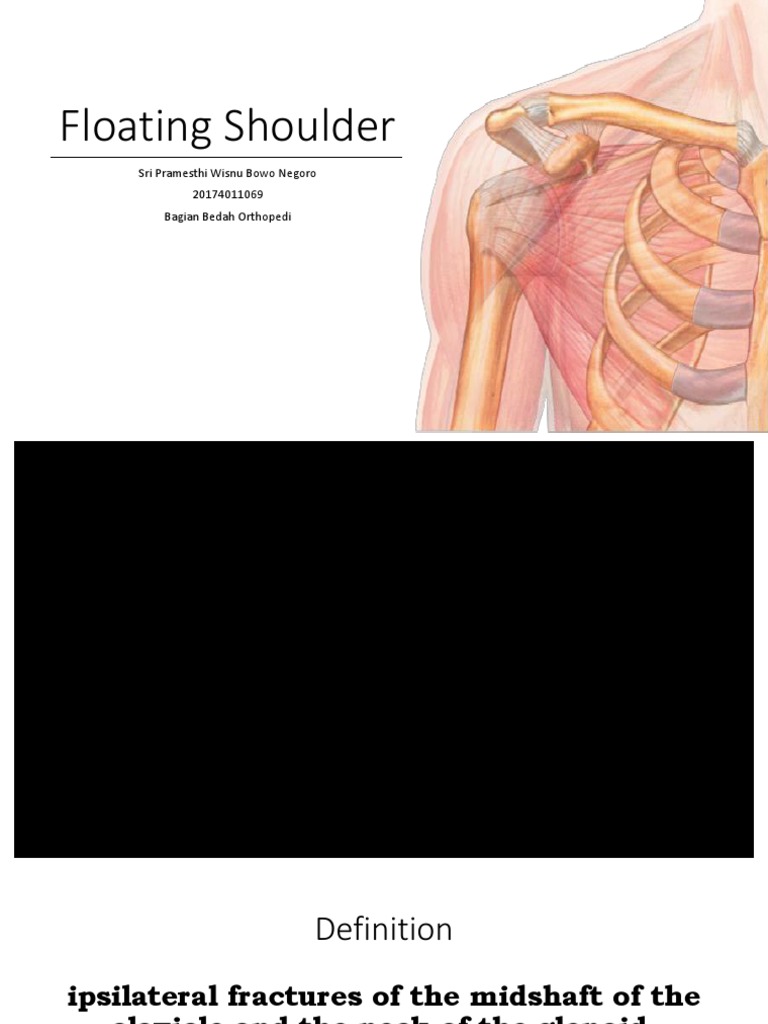 Floating Shoulder: Sri Pramesthi Wisnu Bowo Negoro 20174011069 Bagian ...