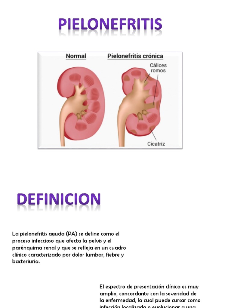 PIELONEFRITIS | PDF | Epidemiología | Especialidades Medicas