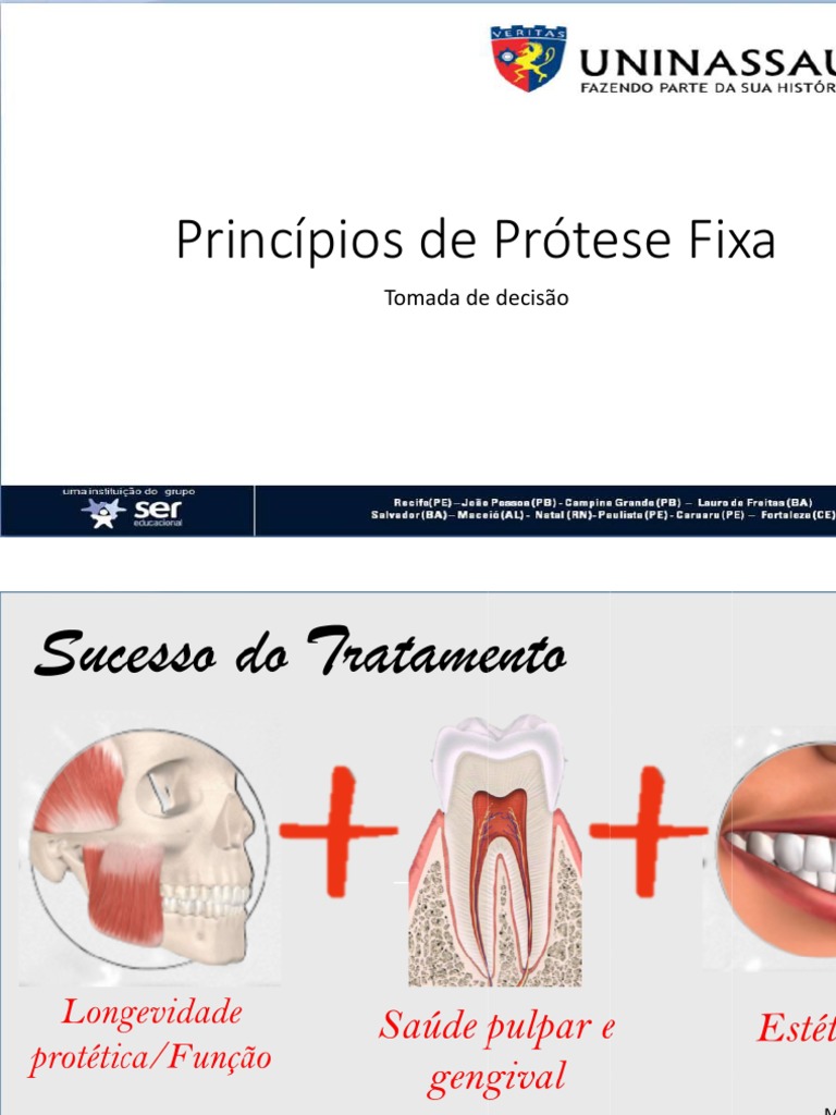 Princípios de Prótese Fixa | PDF | Dente | Prótese