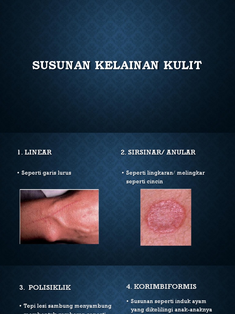 Susunan Kelainan Kulit | PDF