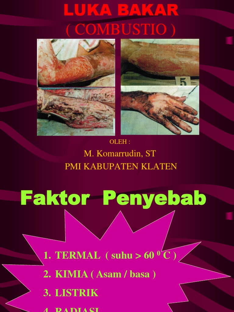 Panduan Lengkap Luka Bakar dan Penanganannya | PDF
