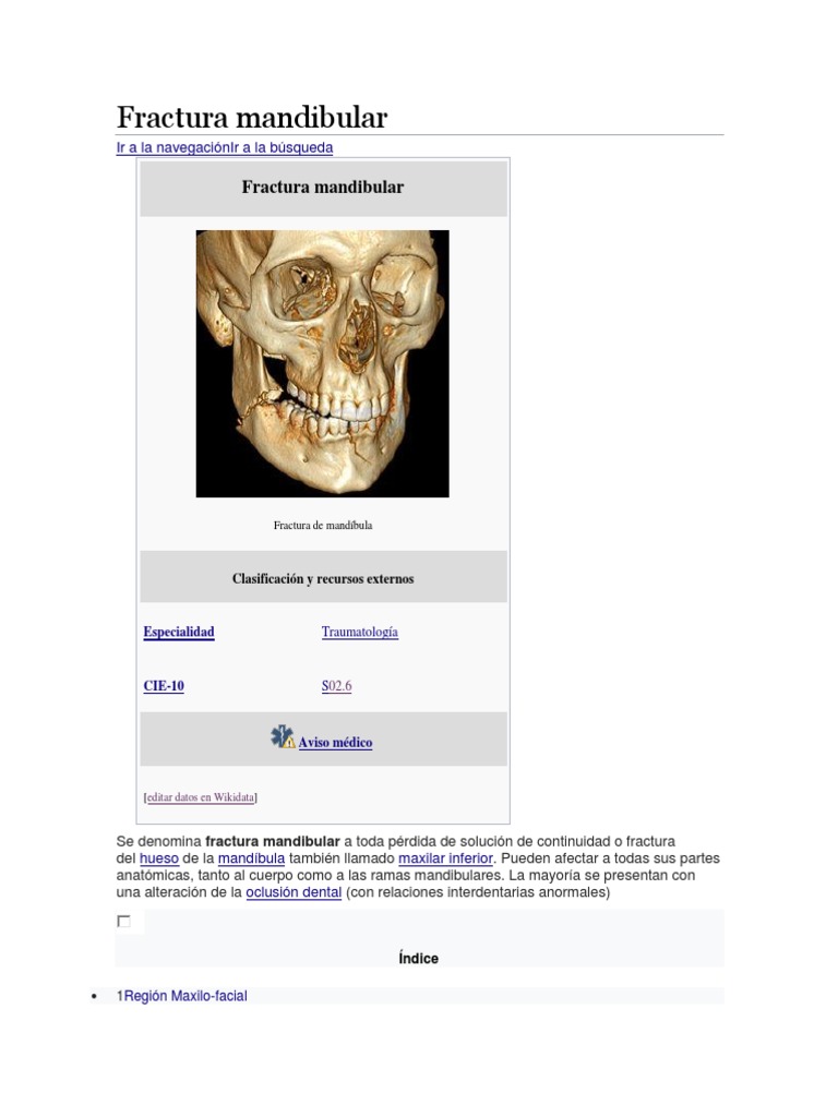 Clasificación de fracturas mandibulares | PDF | Sistema esquelético ...
