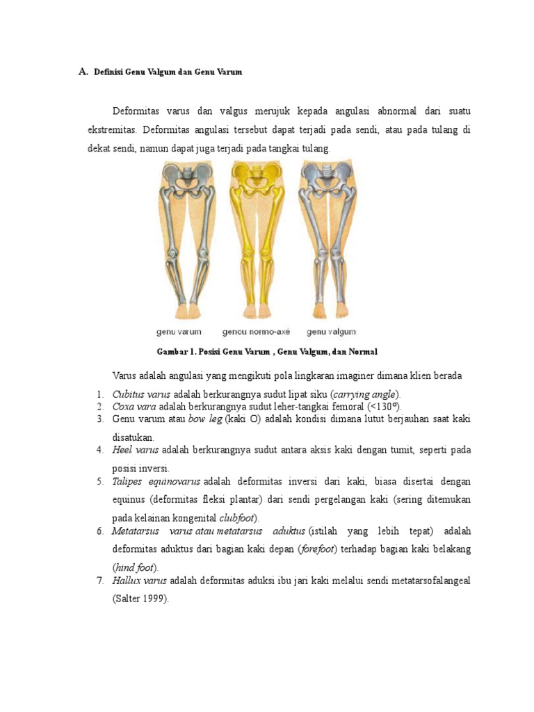 Deformitas Genu | PDF