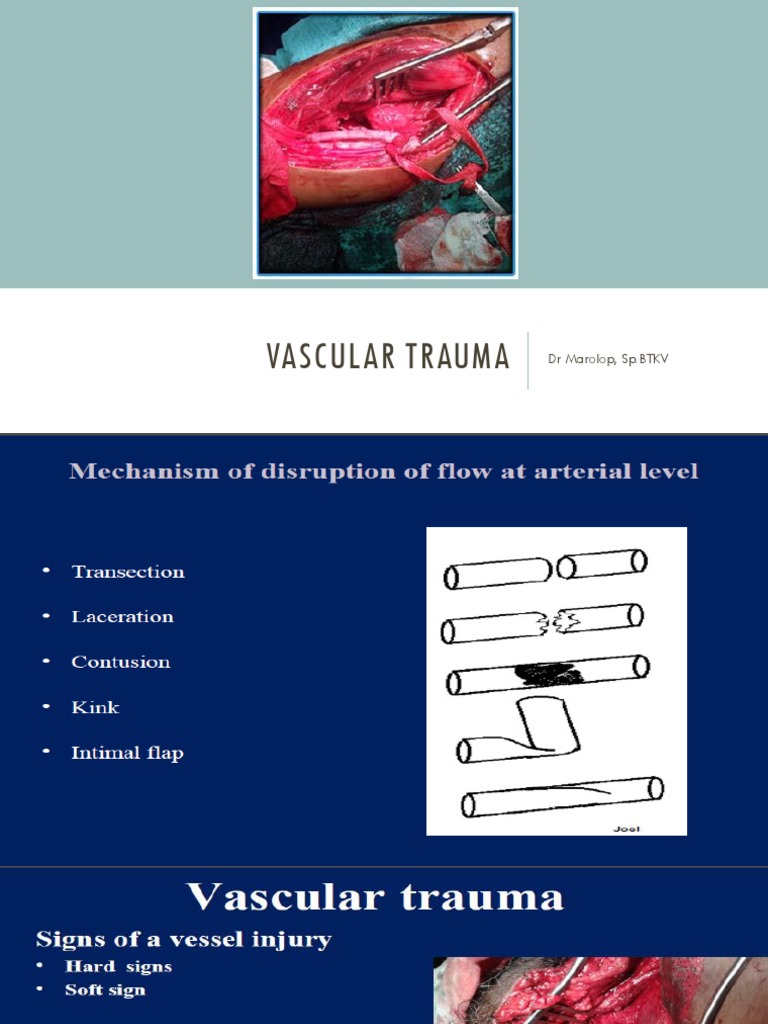 Vascular Trauma: DR Marolop, SP - BTKV | PDF