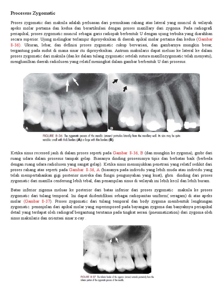 Processus Zygomatic | PDF