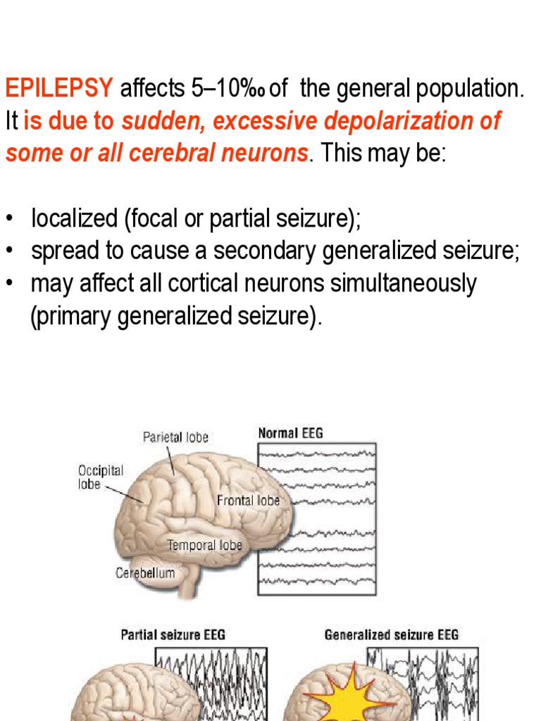 Epilepsy Is Due To Sudden, Excessive Depolarization Of: Some or All ...
