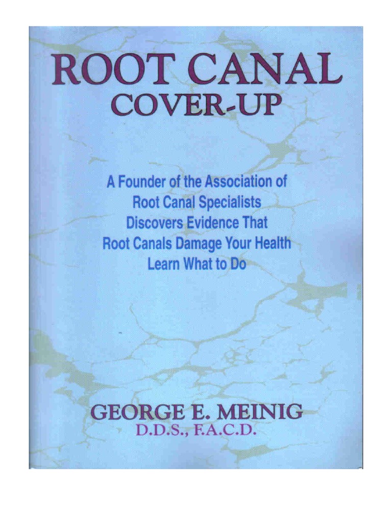 Root Canal Cover Up PDF | PDF