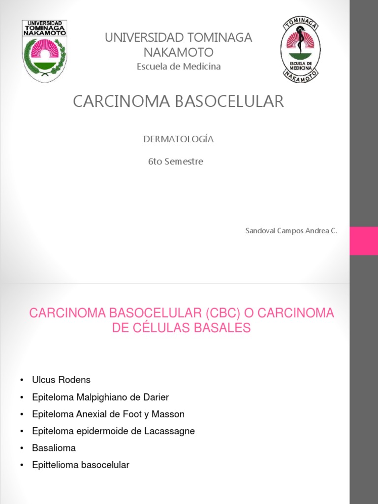 Carcinoma basocelular: Características clínicas, factores de riesgo ...