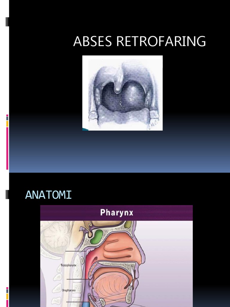 Abses Retrofaring: Gejala dan Penanganan | PDF
