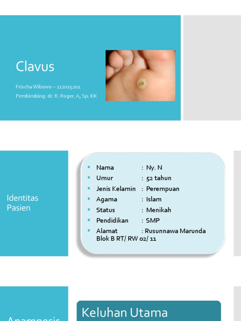 Case Clavus | PDF