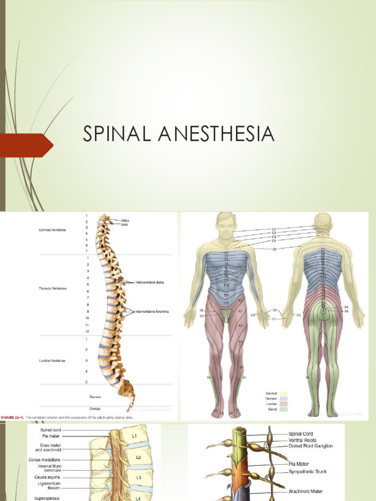 Spinal Anesthesia | PDF