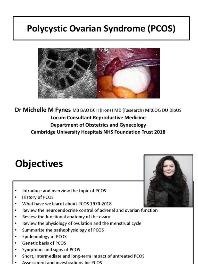 Polycystic Ovarian Syndrome (PCOS) | PDF | Polycystic Ovary Syndrome ...
